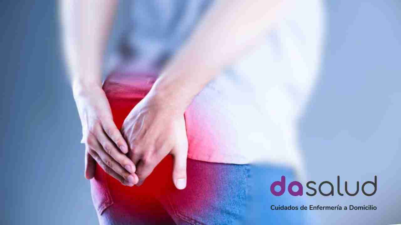 6 claves del Sinus Pilonidal: Síntomas, tratamiento y prevención ...