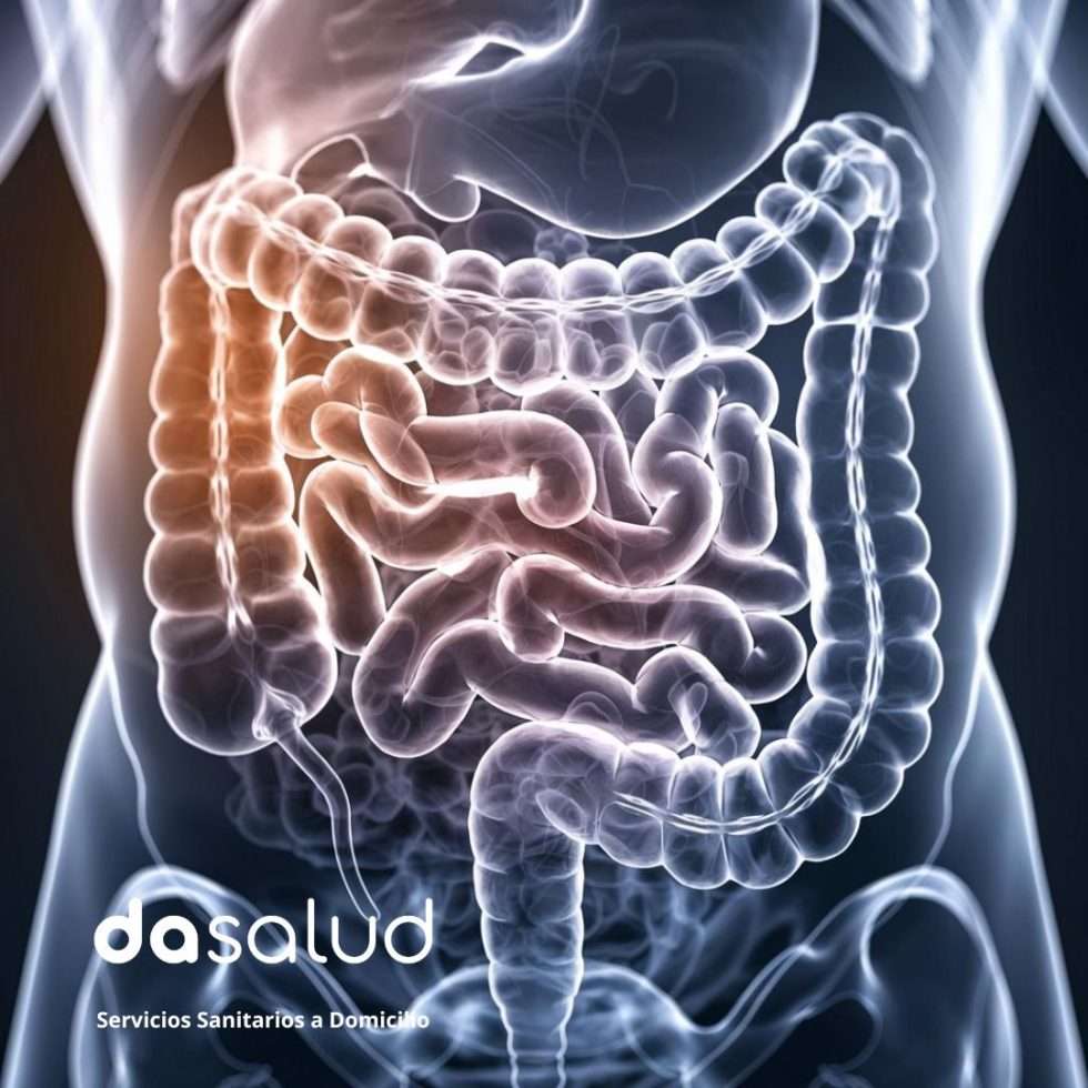 Colocación de Enemas: Guía Completa para Enfermería Domiciliaria en ...